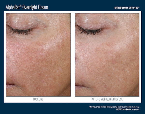 AlphaRet Overnight Cream TRAVEL SIZE – Prischmann Skin