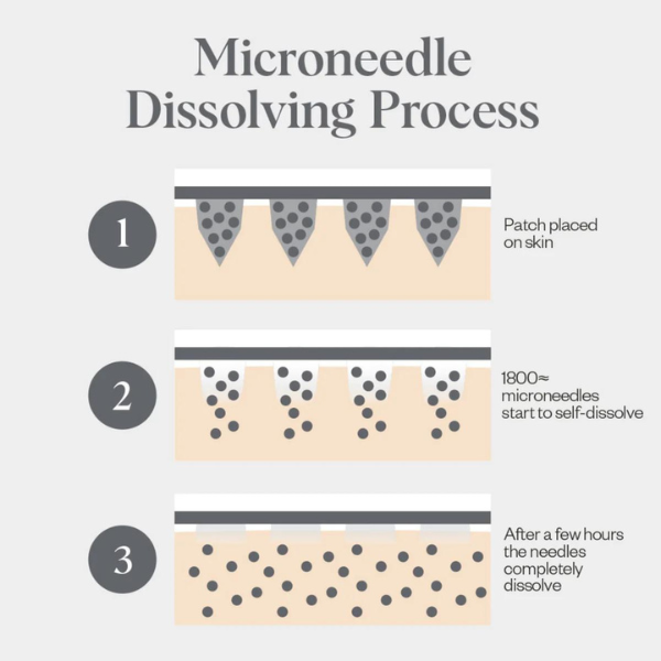 Self-Dissolving Microneedle Patches - 8 Patches (4 pair) – Prischmann Skin