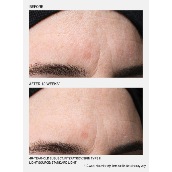 Revox™ Line Relaxer – Prischmann Skin